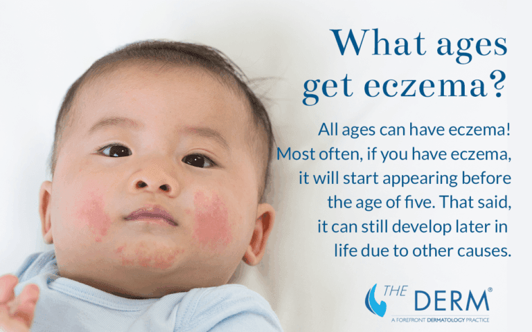 Eczema: What to Know & Treating It Well in Children and Adults - The ...